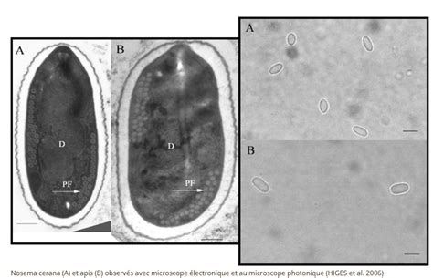 Nosémose — Triple Performance