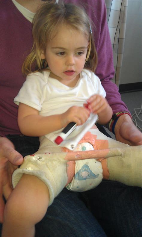 Ddh How To Prevent Hip Dysplasia In Babies Northernmum Northern Mum