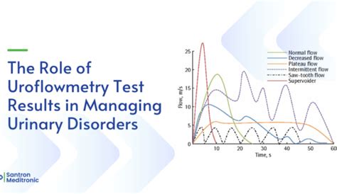 The Role Of Uroflowmetry Test Results In Managing Urinary Disorders