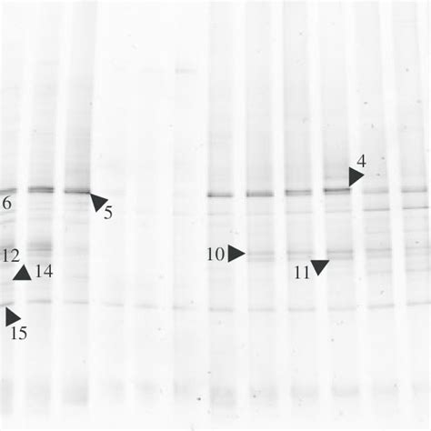 Negative Image Of Denaturing Gradient Gel Electrophoresis Dgge Gel