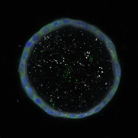 Hif 1 Alpha Antibody 20960 1 Ap Proteintech