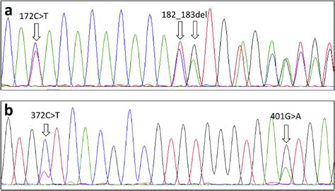 Snapshots Of Portions Of Its2 Chromatogram Showing Polymorphic Sites Download Scientific