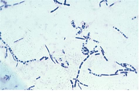 Aerobic Gram Positive Bacilli Flashcards Quizlet