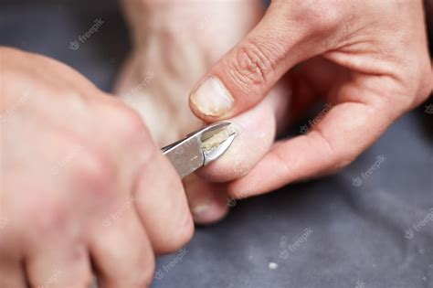 Premium Photo Male Cut Nails With Nail Fungus Fungal Infection On