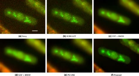 A Feature Based Reconstruction Model For Fluorescence Microscopy Image