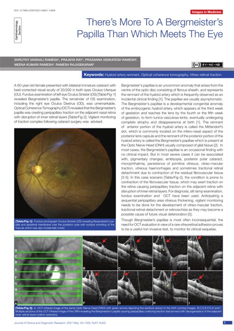 Pdf Theres More To A Bergmeisters Papilla Than Which Meets The Eye