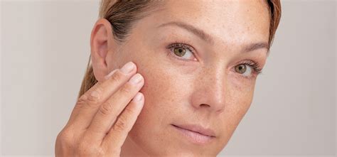 Brown Spots Treatment Mclean And Potomac Dermatology