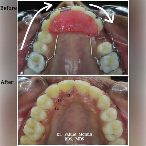 Dr Mohammad Fahim Momin On Linkedin Dentistryworld Dentistrylife