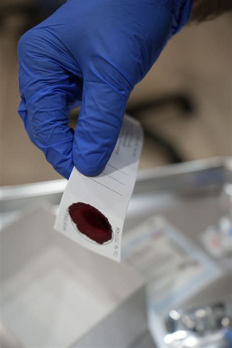 Epigenetic Testing Newmarket On Nhf Clinics