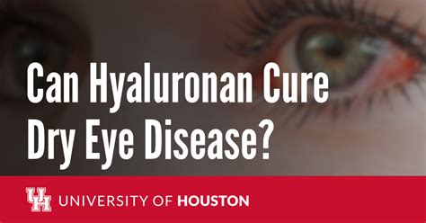 Can Hyaluronan Cure Dry Eye Disease University Of Houston