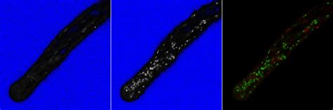 Issues With Costes Auto Threshold On Biop Jacop Image Analysis