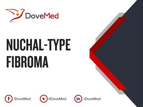 Nuchal Type Fibroma Dovemed