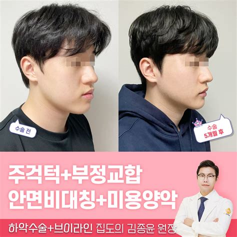 이유 구강악안면외과 치과의원 💕뼛속까지 예쁜 이유💕 외모적 고민