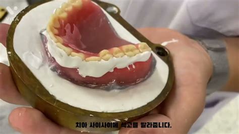 총의치기공실습 1 상악 납의치 매몰 20210559 박성민 YouTube