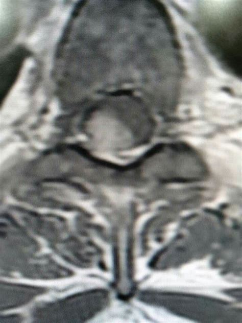 Pin On Radiologia