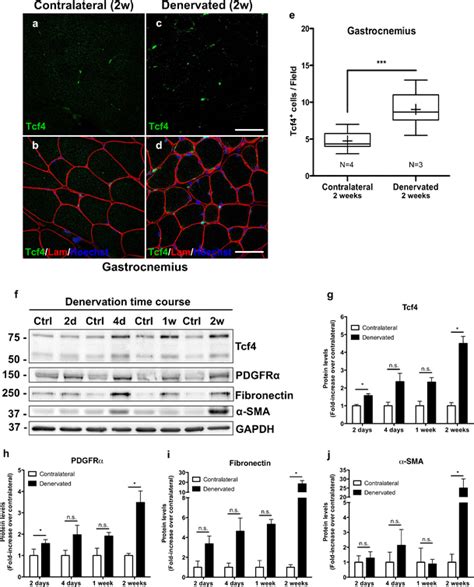 Number of Tcf4 positive cells increase and elevated Tcf4 PDGFR α SMA Download Scientific
