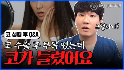 코 성형 후 많이 물어보시는 질문 모음집 한 영상으로 끝내세요 YouTube