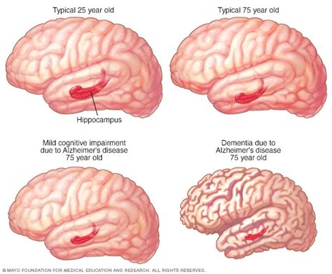 Brain Memory Center