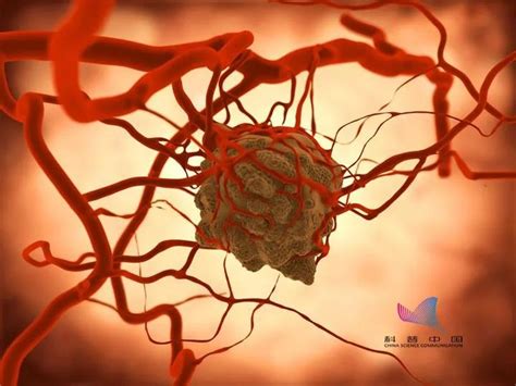体检查出结节、息肉、囊肿、增生哪个才是癌症的先兆？ 知乎