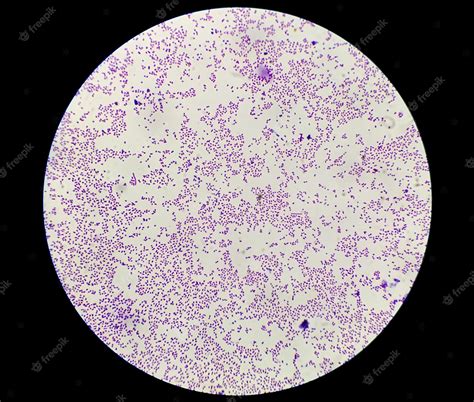 Staphylococcus Aureus Bacterias Colonia Tinción De Gram Imagen