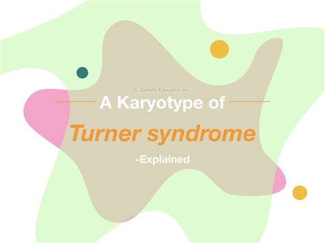 Turners Syndrome Karyotype