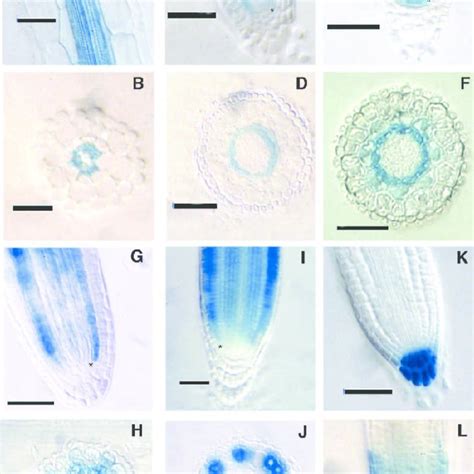 Stages Of Lateral Root Primordium Development Shown Are Nomarski Download Scientific Diagram
