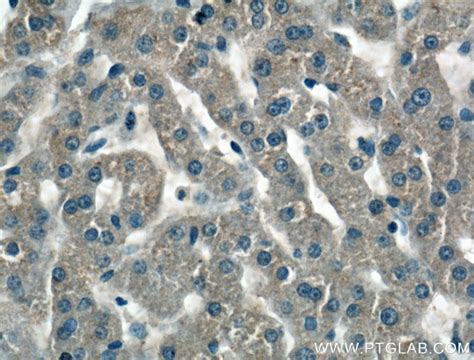 Antithrombin Iii Antibody 16414 1 Ap