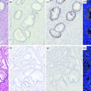 Virtual Ihc And Channel Molecular Map Colorization For A A D Benign