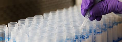 Lgc Acquires Seracare Life Sciences Strengthening Its Position In