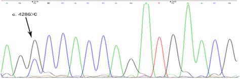 Electropherogram Of The Identified Mutation At The Position 428 G C Download Scientific