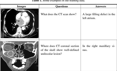 Table 1 From Deep Neural Networks And Decision Tree Classifier For Visual Question Answering In