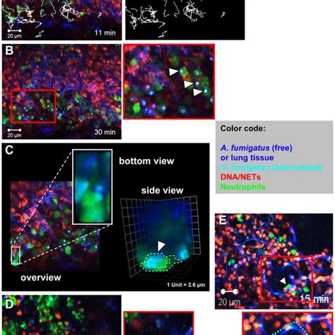 Neutrophil Motility And Interaction With Fungal Elements In Living Lung