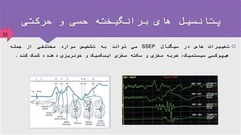 Monitoring Anesthesia Pptx