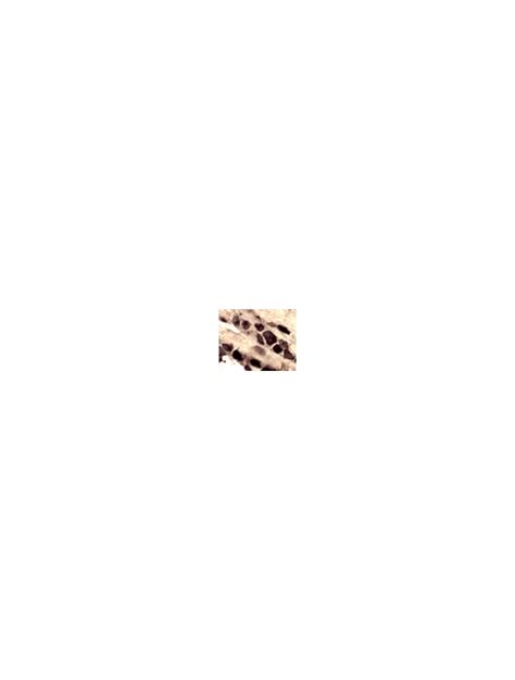 Amyloid Beta Precursor Protein App Rabbit Polyclonal Antibody