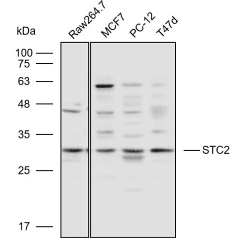 Solarbio K110563p Anti Stc2 Polyclonal Antibody 试剂仪器耗材