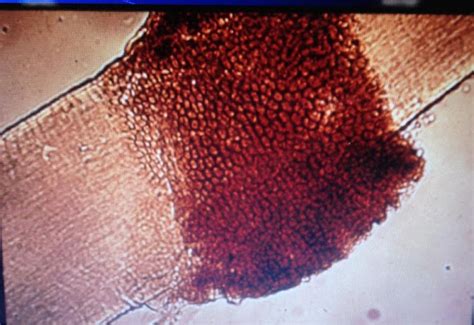 Lecture Notes In Medical Technology Lecture 16 INTRODUCTION TO MYCOLOGY