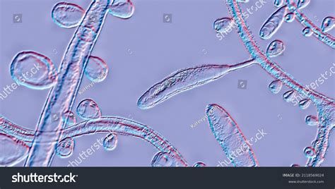 True Hyphae