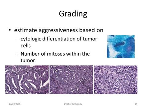 Staging Grading And Spread Of Tumors