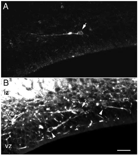 Dii Labeled Migrating Cells In The Vz Svz Are Tuj1 Positive A Download Scientific Diagram