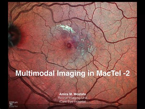 Multimodal Imaging In Mactel 2 Pdf