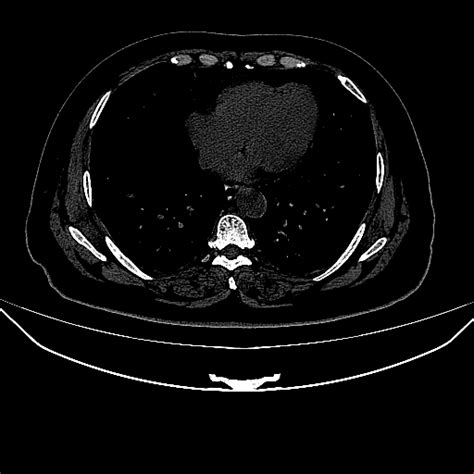 Error Command Errored Out With Exit Status 1python 38 Stack Overflow