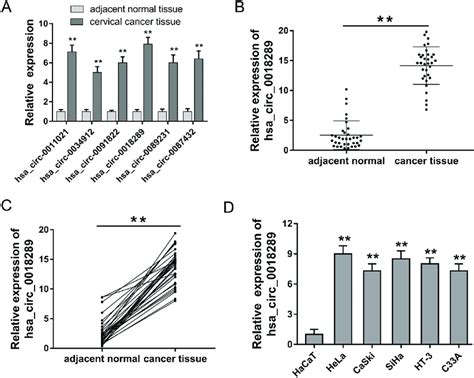 Hsacirc0018289 Was Up Regulated In Cervical Cancer Tissue And Cells