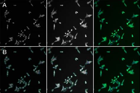 Single Particle Analysis Workflow Thermo Fisher Scientific Uk Single Particle Analysis Workflow Thermo Fisher Scientific Uk