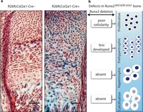 Chondrocyte Specific Regulatory Activity Of Runx2 Is Essential For