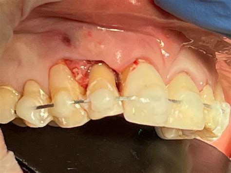 Dental Trauma Dentist Isle Of Man