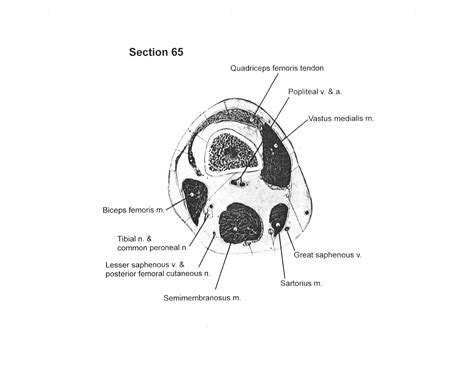 Cross Sectional Human Anatomy
