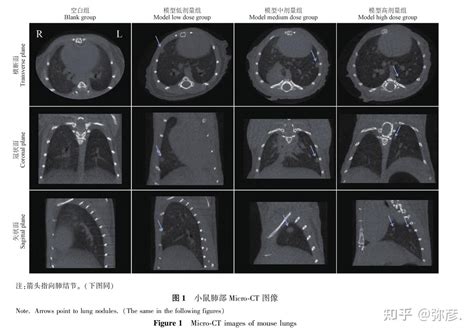 Protocol分享｜小鼠肺腺瘤动物模型构建 知乎