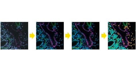 Nikon Introduces The Ax R Mp With Nsparc Super Resolution Multiphoton