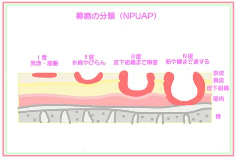 Nastea