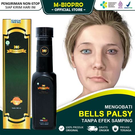 Obat Bells Palsy Paling Ampuh Bells Palsy Alami Bells Palsy Menahun Bells Palsy Bibir Miring